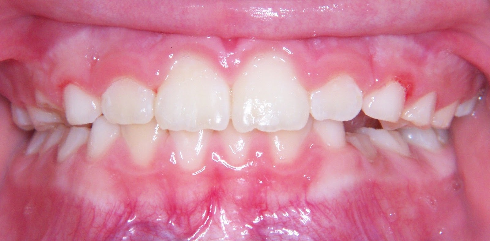 Dental Functional Shift at Susan Tucker blog