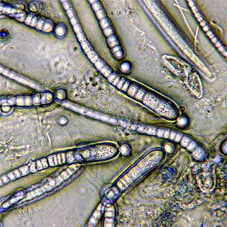 Η "βρώμικη" πλευρά του σαπουνιού και η αντιβακτηριδιακή μόδα | Χειροποίητον