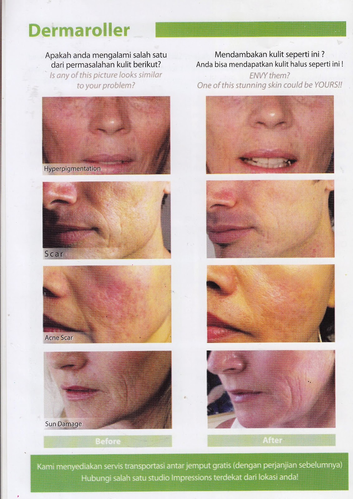 TAMPIL CANTIK DAN MENAWAN DENGAN TANAM BENANG: FUNGSI TANAM BENANG-10-