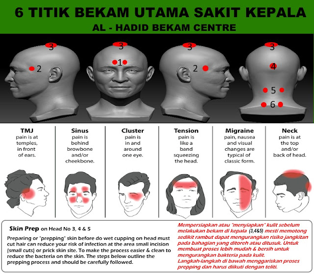 SAKIT KEPALA | HEAD PAIN ~ AL-HADID BEKAM CENTRE