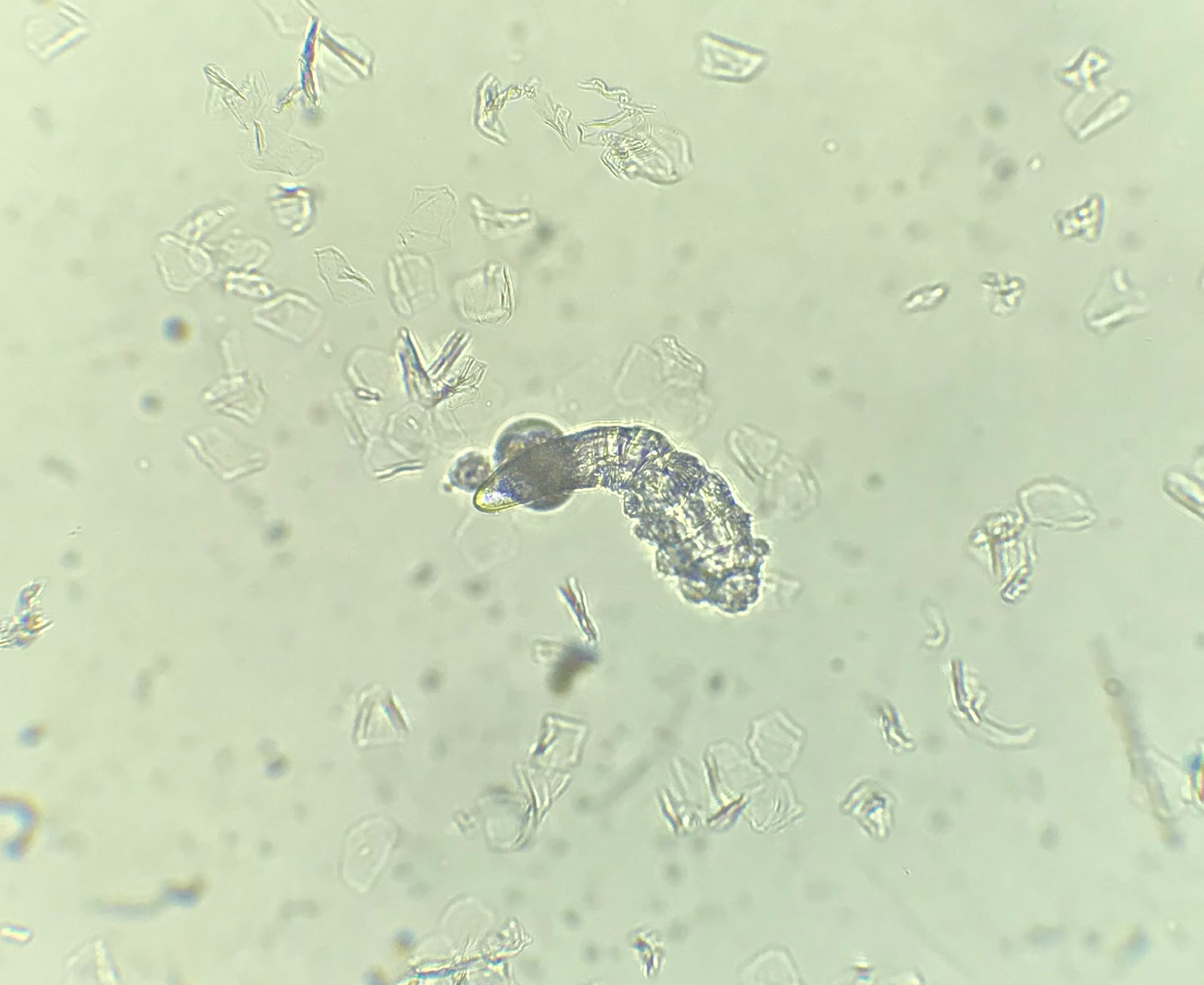 Creepy Dreadful Wonderful Parasites: Case of the Week 535