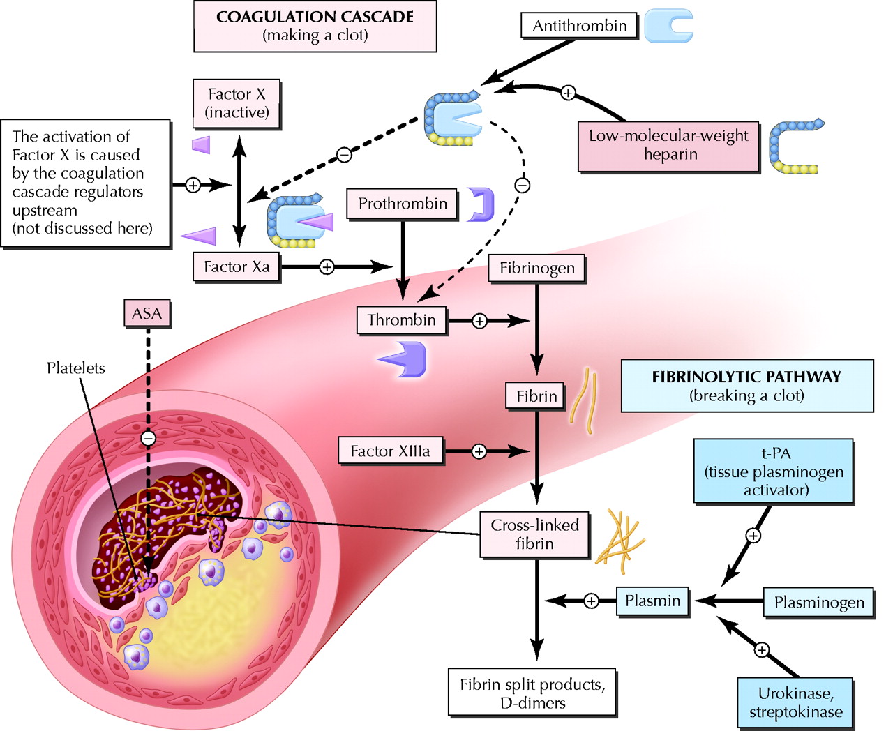 Patofisiologi Stroke
