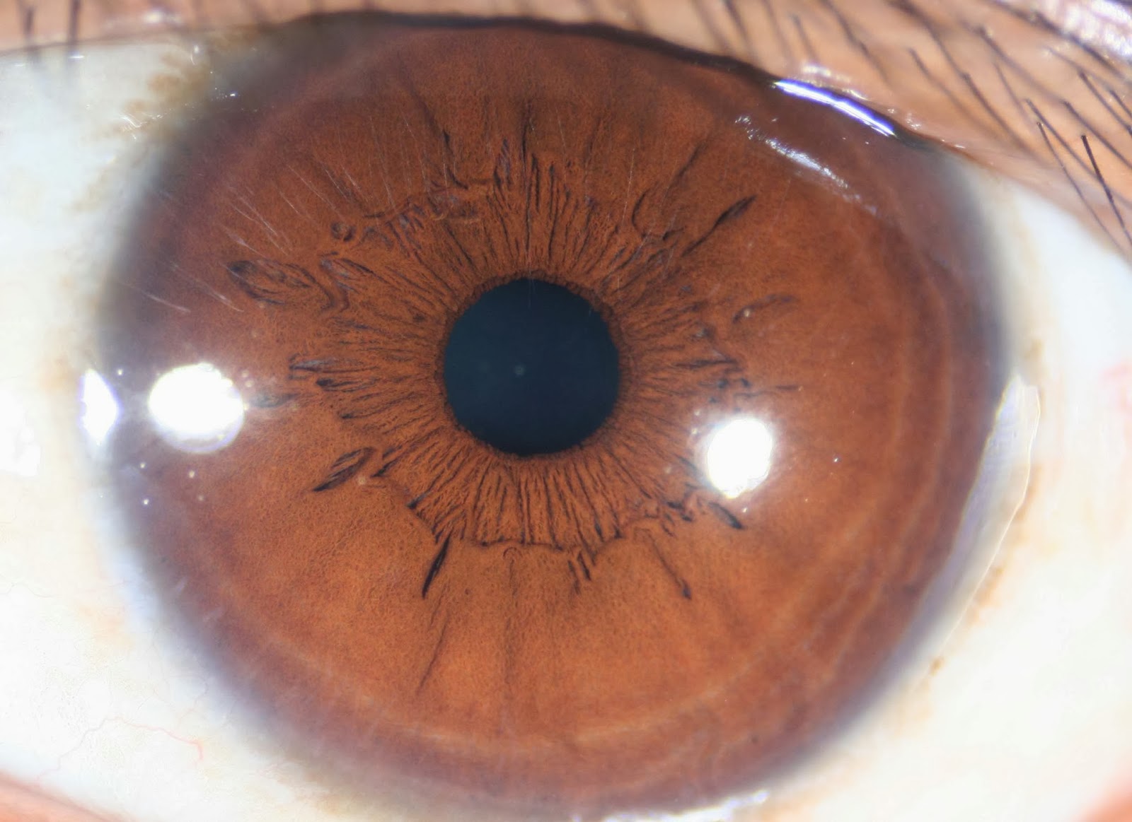 Modern & Multidimensional Iridology: IPB, Pupil, Pupillary Zone ...