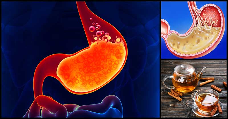 Acidity Problems? Here’s Cinnamon To The Rescue | Dr Farrah MD