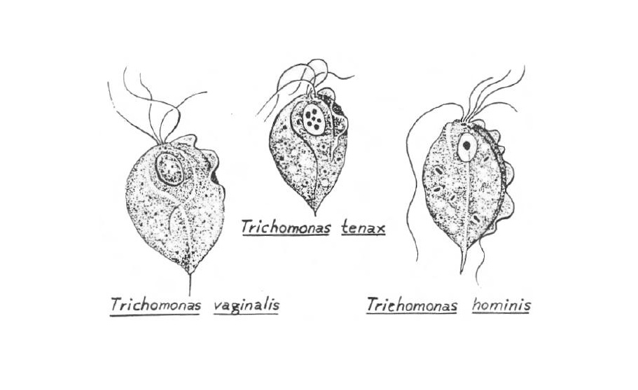 Parasitologia: Trichomonas