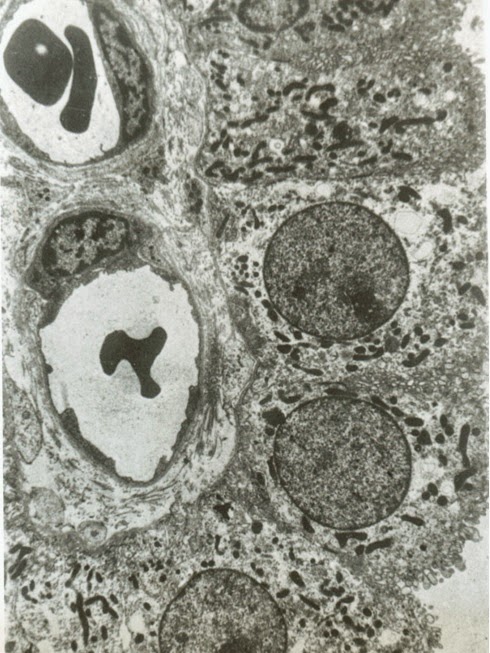 Atlas Histológico UNIFOR-MG: Plexo coroide