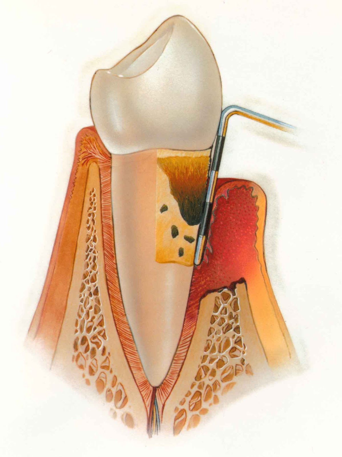 Introducción a la Periodoncia: marzo 2012