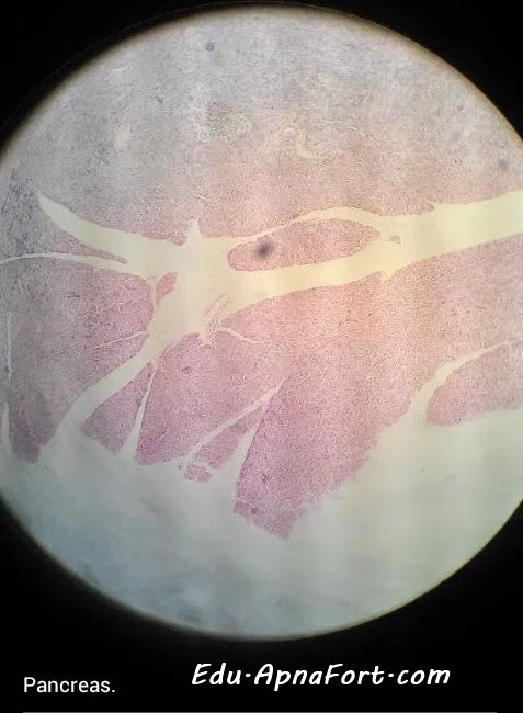 Educational Blog : Pancreas slides