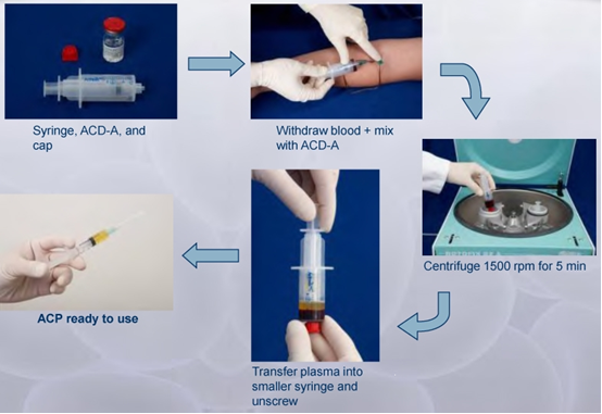 Journal Of A Princess..: Learning To Walk Again