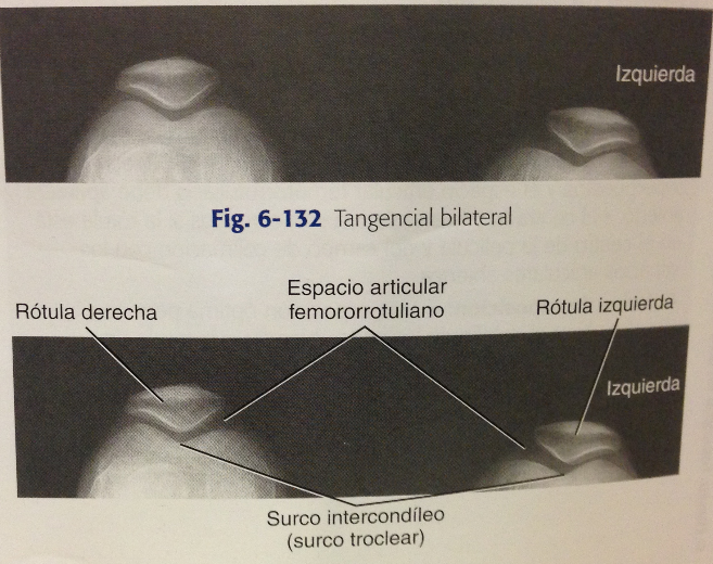 NOSOLOTECNICOS: AXIAL DE RODILLA