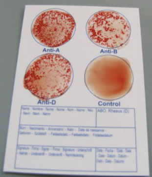 Naturfag 2015/2016: Bestemmelse av blodtype med ELDON-kort