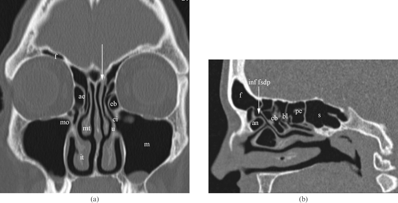 Auger Gear Image: Agger Nasi Air Cell