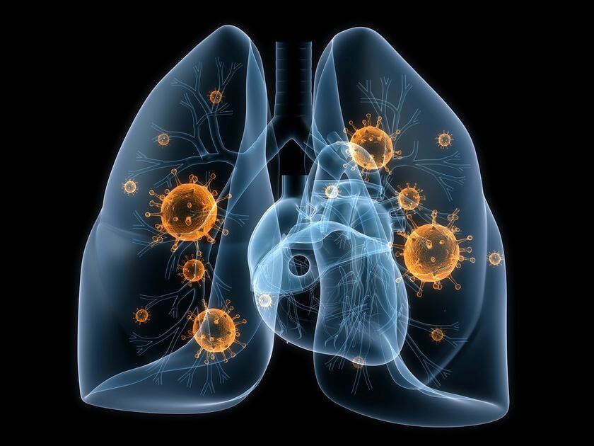 Lung Microbiome