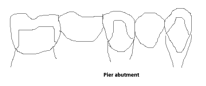 Pier (intermediate) bridge abutments