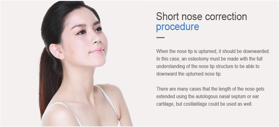 [Nose:Rhinoplasty] Short and Upturned Nose Correction