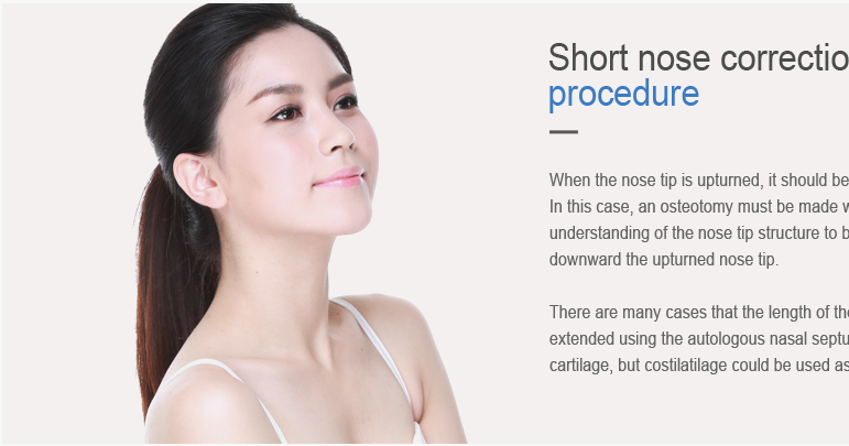 [Nose:Rhinoplasty] Upturned Nose Correction