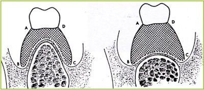 Dentistry and Medicine: Concept of Neutral Zone