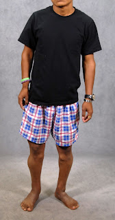 Young Adult with Multiple Hereditary Exostoses | Congenital Hand and ...