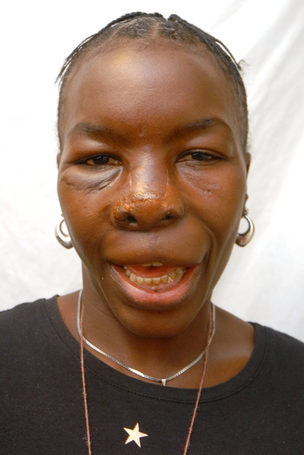 DEBRA BELL MERCY IN WEST AFRICA: SIERRA LEONE-Ramatu Koroma-I was in ...