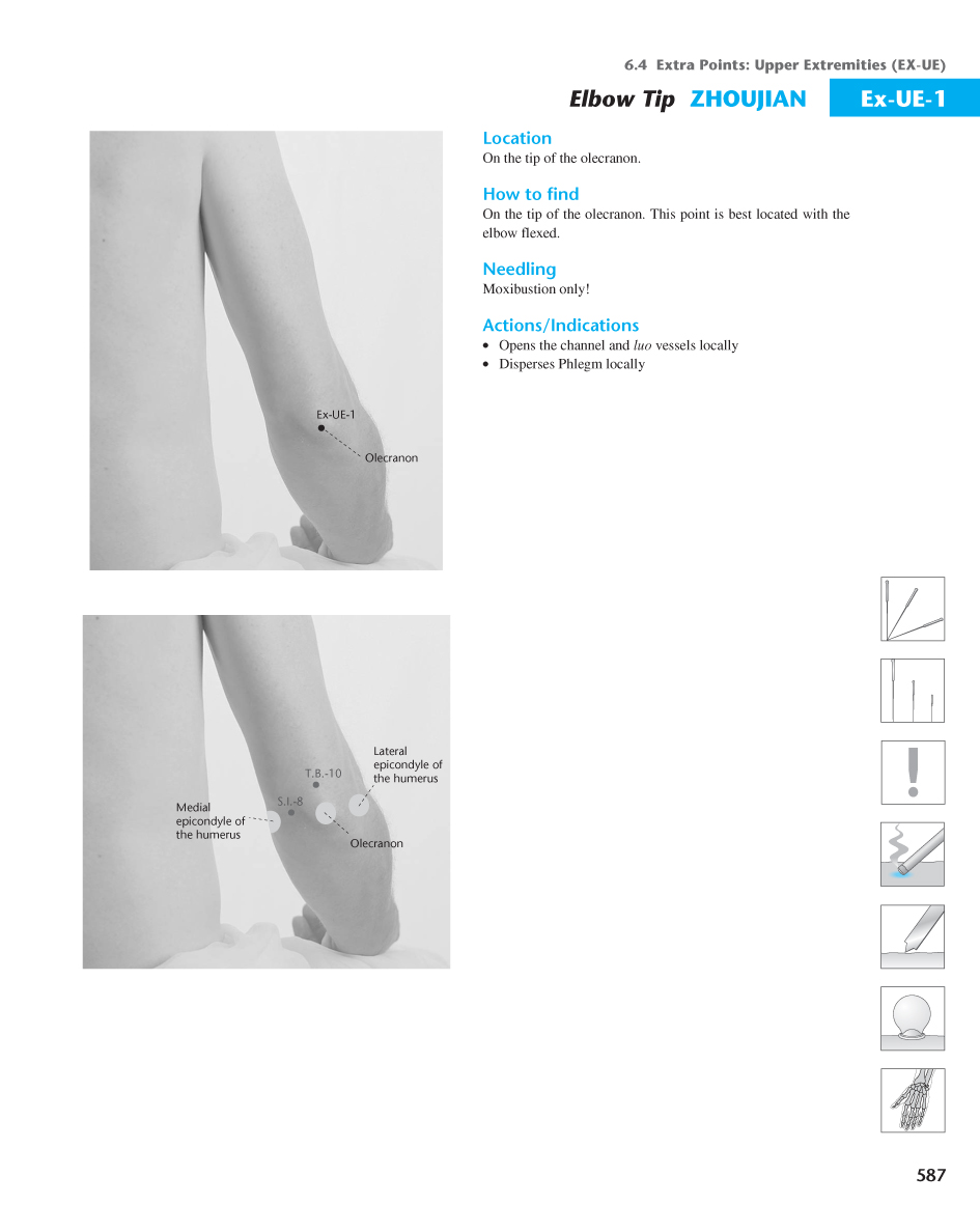 Acupuncture Masters: Acupuncture Points Database - Extra Points