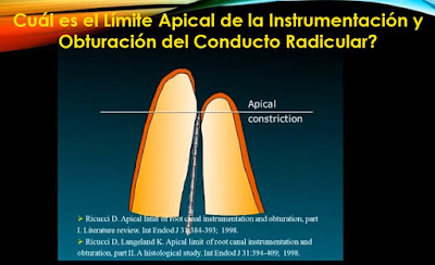 WEBINAR: Conformación y desinfección del Tercio Apical - Dr. Marlon ...