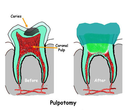 Dr. Frank Liu's Dental Blog