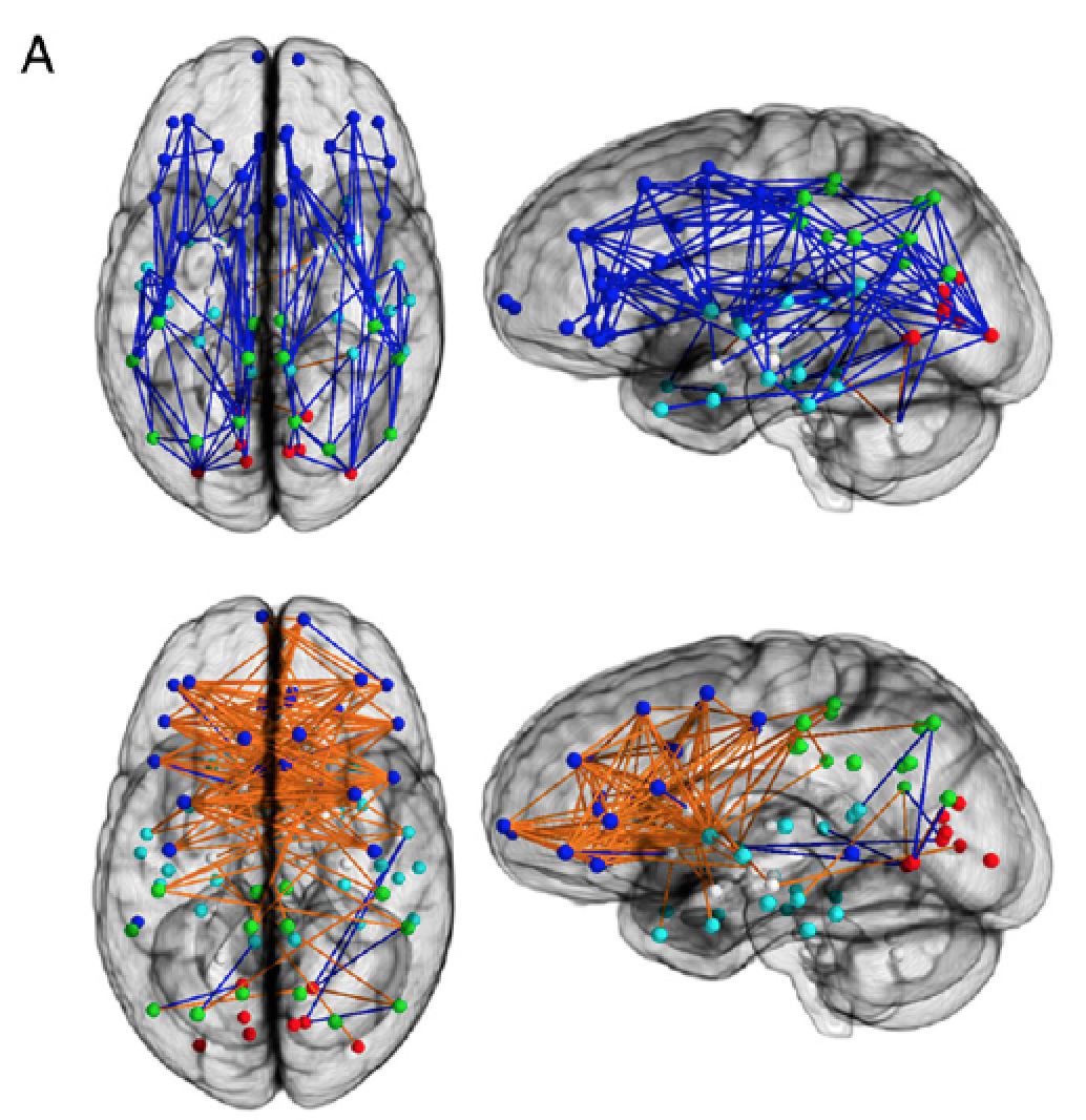 Sex on the brain – a tale of two studies