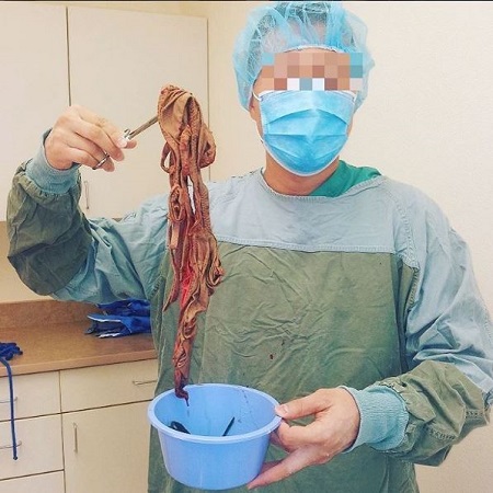 SHOCKING! See What a Vet Doctor Pulled Out from an Animal's Intestine ...