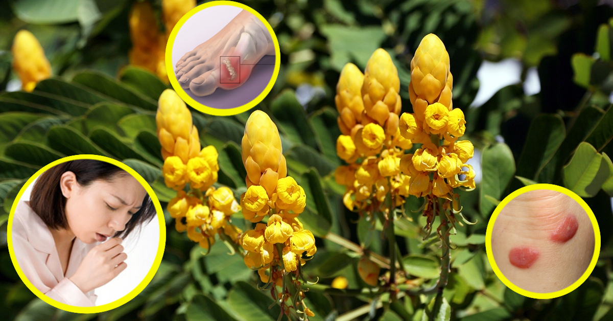 Health Benefits of Ringworm Bush (Akapulko)