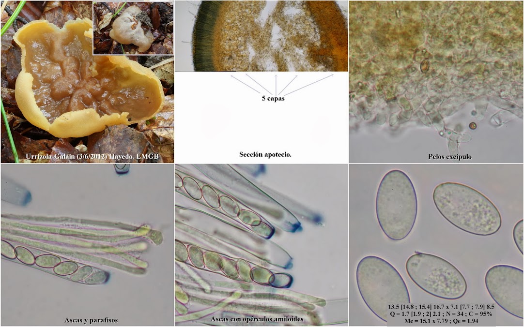 Microscopía de hongos. Vol 4. O - R: Peziza varia