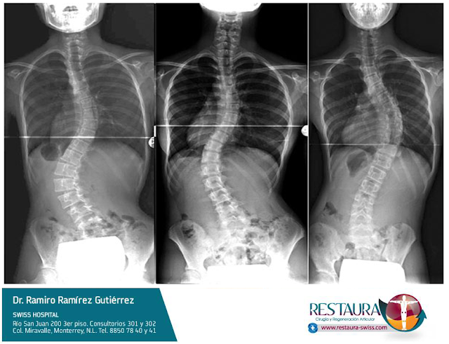 DrColumna: junio 2015