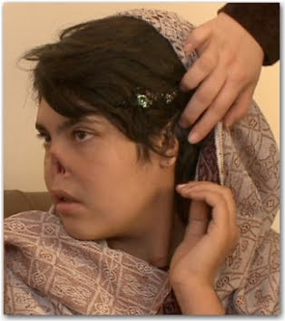 Aisha Mohammadzai (Bibi Aisha) - Life ExamplesLife Examples