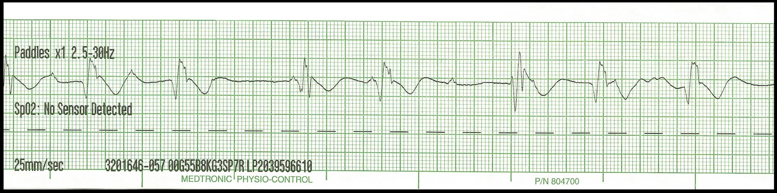 Code Blue: Shop till you drop