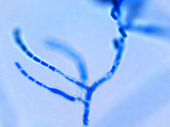 Fun With Microbiology (What's Buggin' You?): Arthrographis species