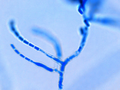 Fun With Microbiology (What's Buggin' You?): Arthrographis species