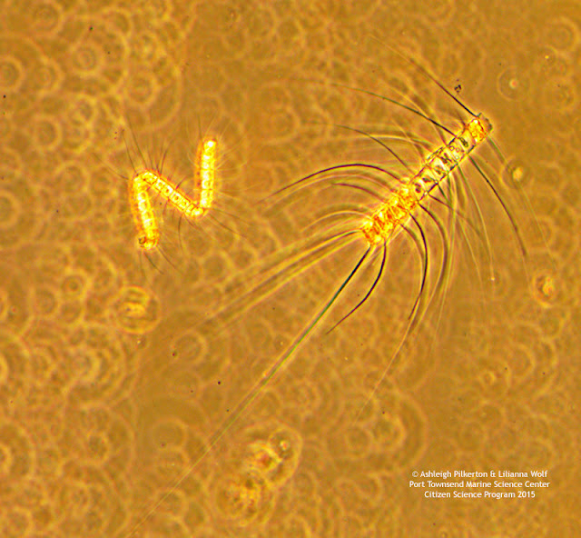 Microscope World Blog: Plankton (Chaetoceros) under the Microscope