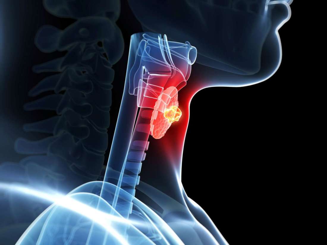 Boererate.com: Skildklierprobleme