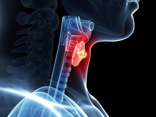 Boererate.com: Skildklierprobleme