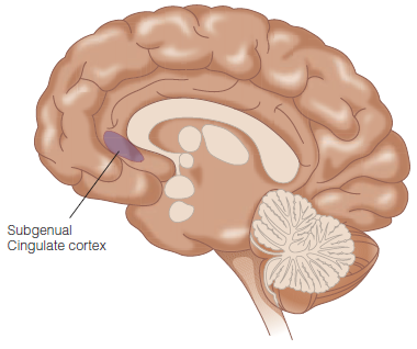 Imperfect Cognitions: Neuropsychiatry Conference 2018