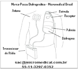 Alta Tecnologia em Ação