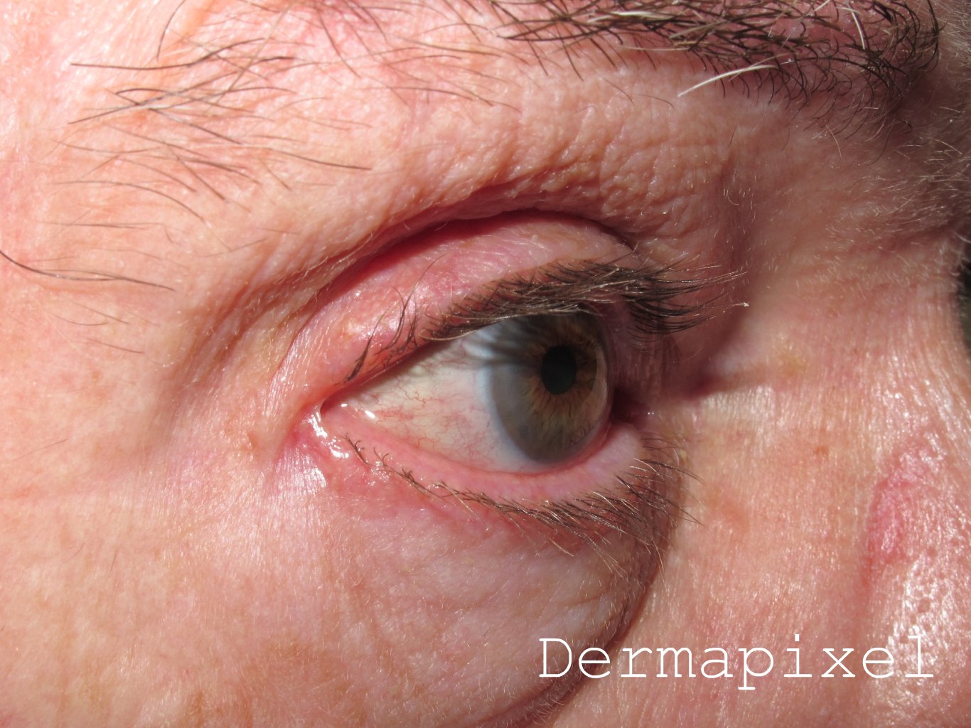 Dermapixel: abril 2013