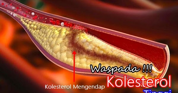 9 Makanan Turunkan Kolesterol ‘Jahat’ Dalam Badan Yang Wajib Anda Tahu