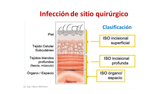 2 . Clasificacion de la infeccion de sitio quirurgico