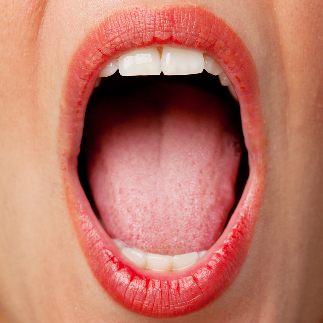 Sonodent Ağız ve Diş Sağlığı Polikliniği: 10 Adımda Ağız Kokusuna Son ...