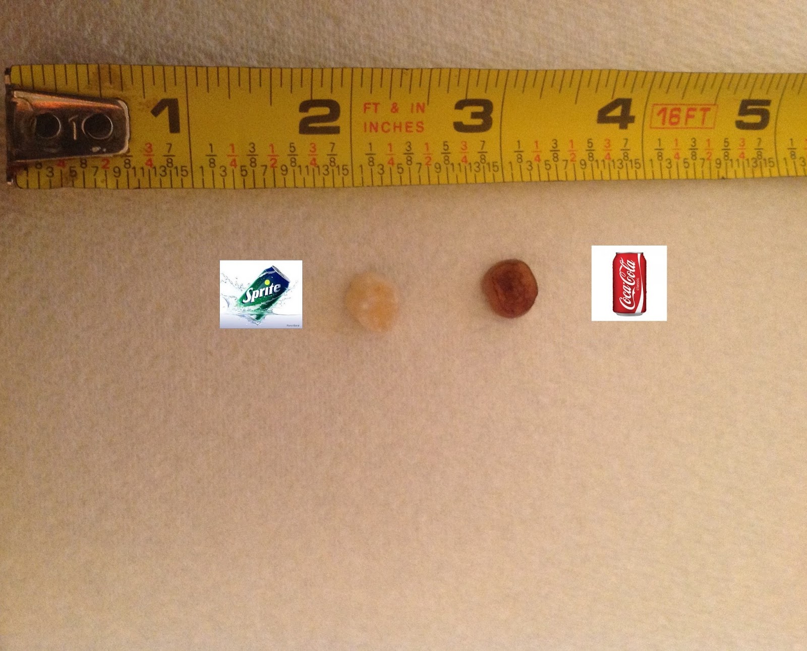Comparing the Corrosive Effect of Coke and Sprite: This Stuff Will Rot ...