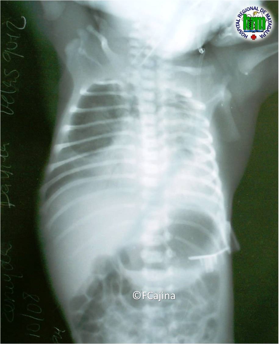 Dr. Frank Cajina Gómez: Atlas de Defectos Congénitos HECAM