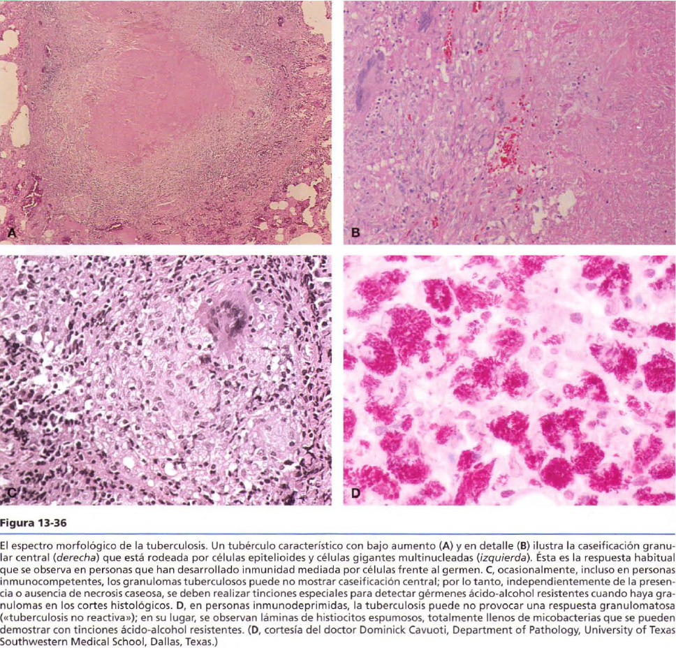 Medicina UNLP: PATOLOGÍAS RESPIRATORIAS I: ANOMALÍAS CONGÉNITAS, EDEMA ...