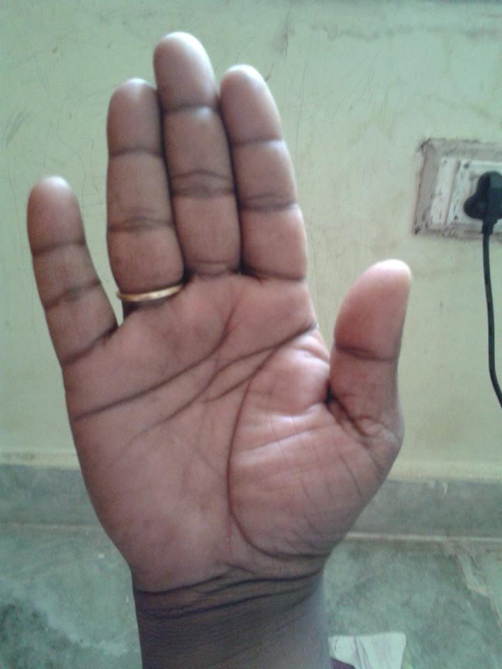 Island On Head Line Underneath Mount Of Saturn Palmistry ~ INDIAN PALM ...