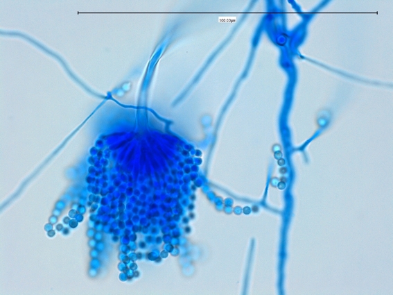 Fun With Microbiology (What's Buggin' You?): Aspergillus versicolor