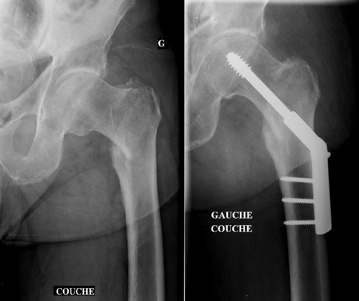 Claude Guinegagne: 1964+ Chatenay